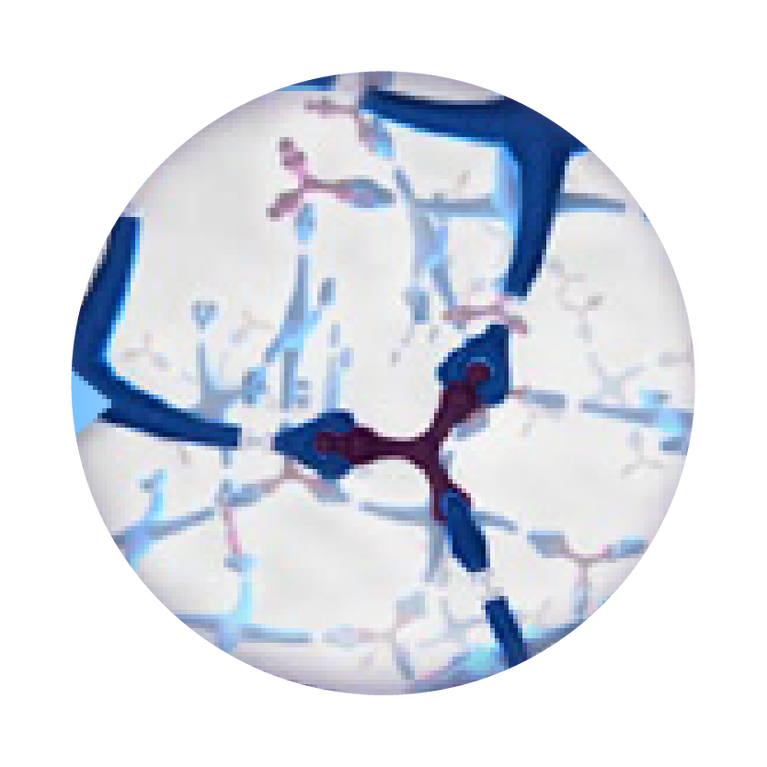 Product and Procedure – SpaceOAR Hydrogel - Boston Scientific