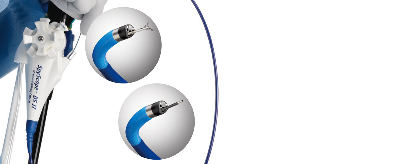 エンドスコピー（消化器分野）