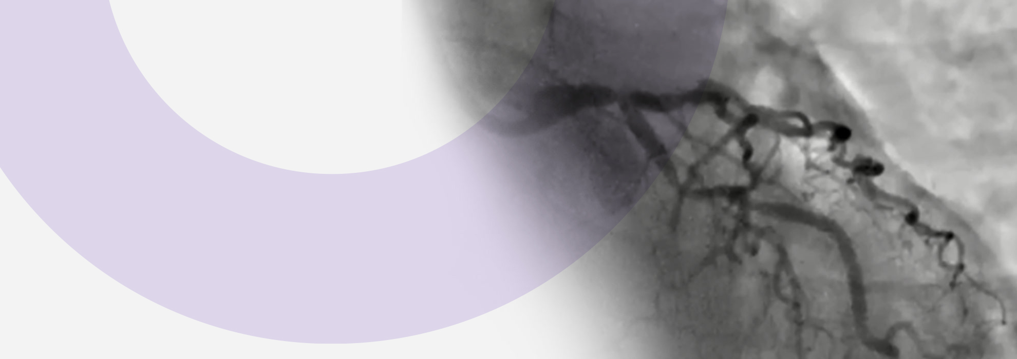 Bifurcation - Boston Scientific