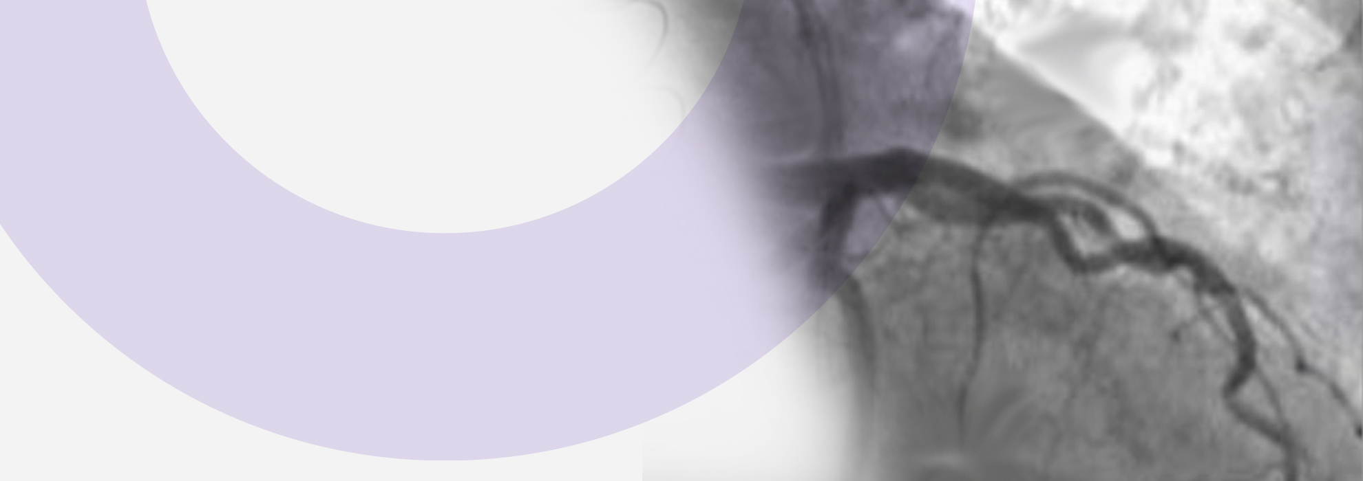 Left Main - Boston Scientific