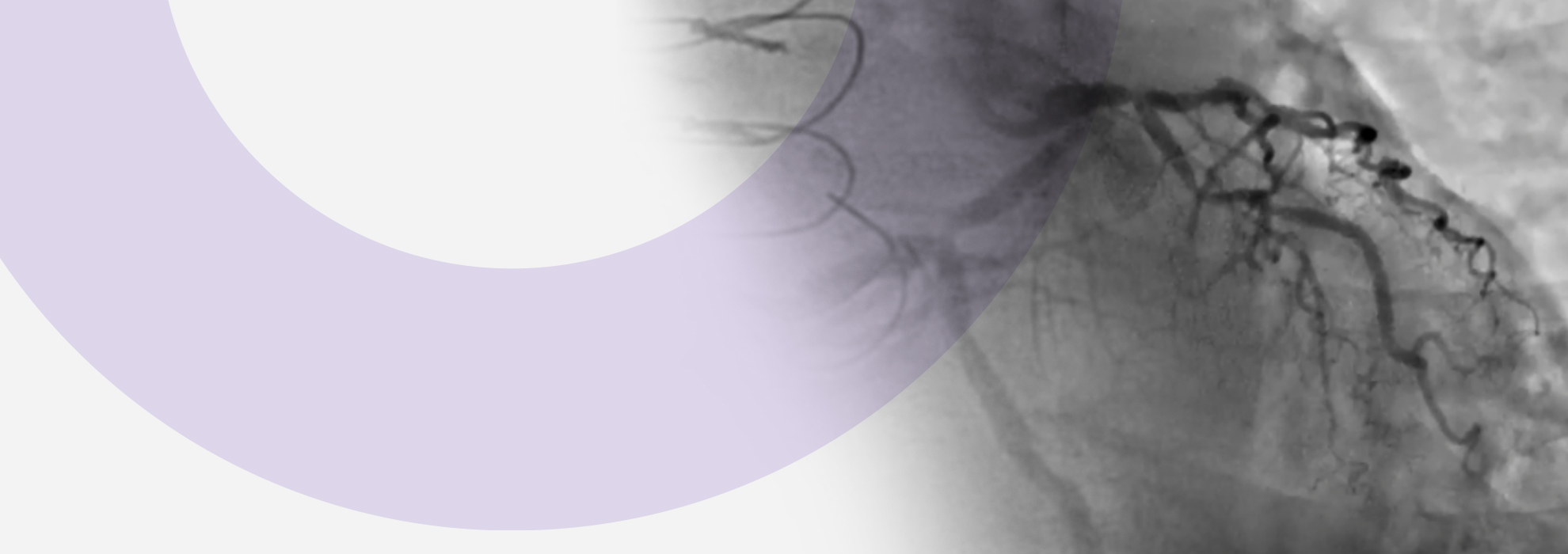 Multi Vessel Disease - Boston Scientific