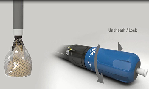 Lotus Valve Implant - Boston Scientific
