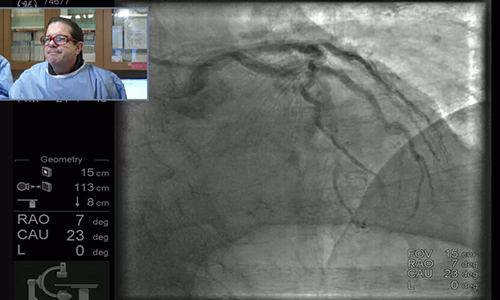 Complex PCI - Boston Scientific