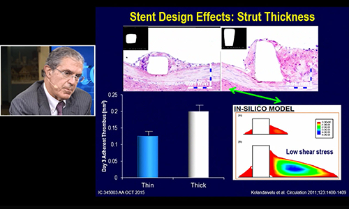 SYNERGY Science Behind the Stent - Boston Scientific