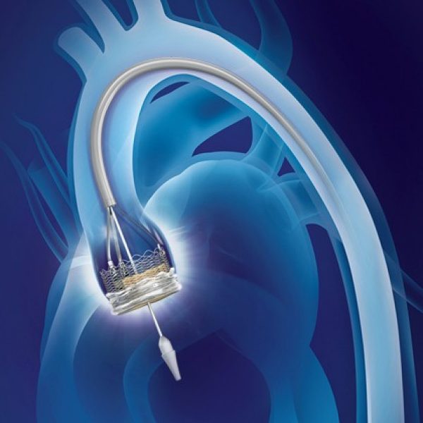 LOTUS Edge™ VALVE SYSTEM | Boston Scientific | Boston Scientific