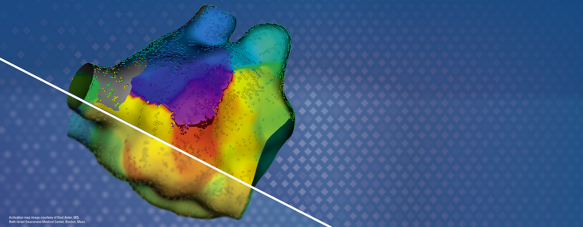 Advancing Medical Technology | Boston Scientific - Boston Scientific