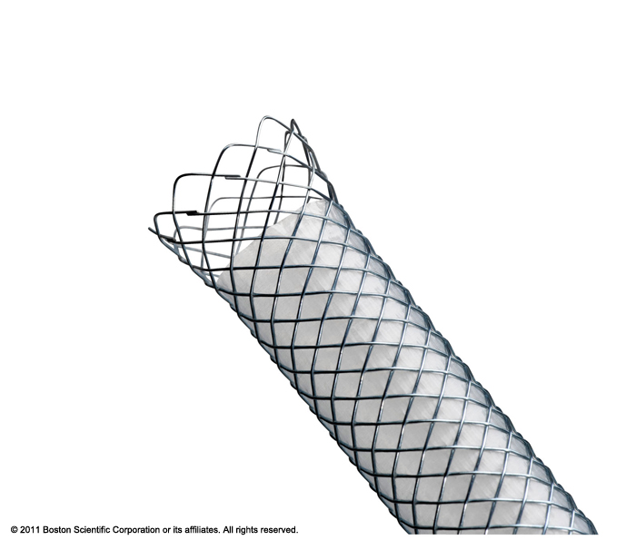 Biliary Metal Stent Images - Boston Scientific