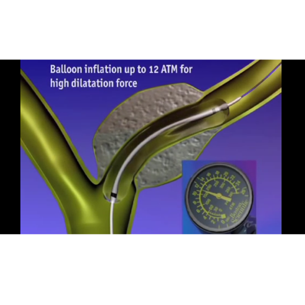 Hurricane RX Biliary Balloon Dilation Catheter - Boston Scientific