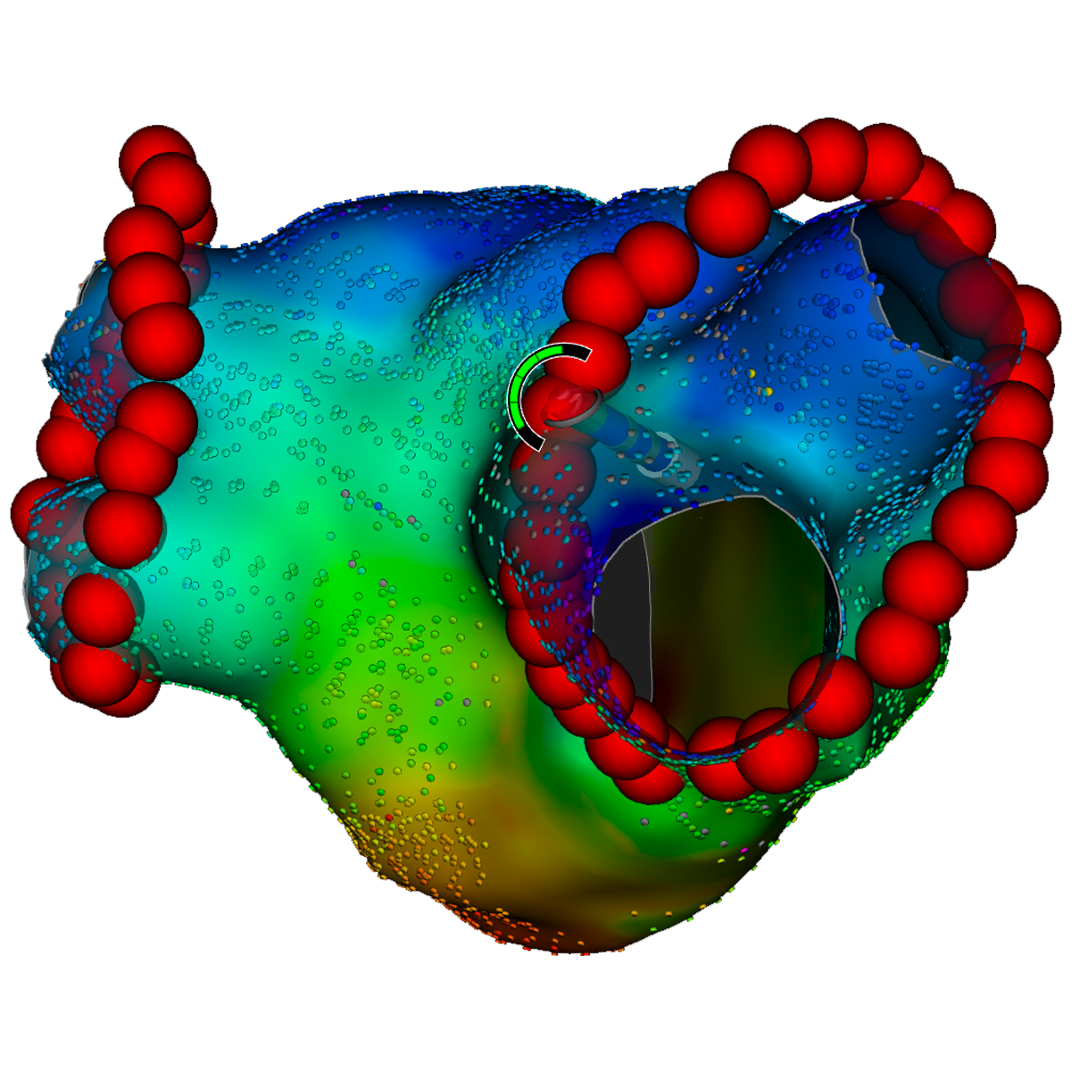 Cardiac Mapping System Software – RHYTHMIA HDx - Boston Scientific