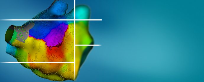 Electrophysiology | Boston Scientific