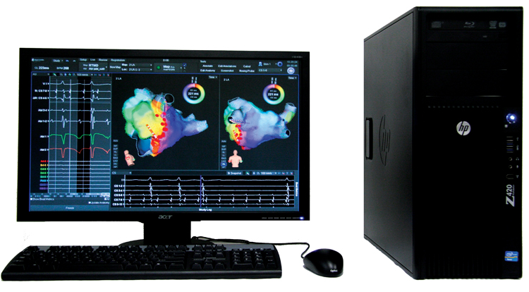 Rhythmia™ Mapping System | Boston Scientific