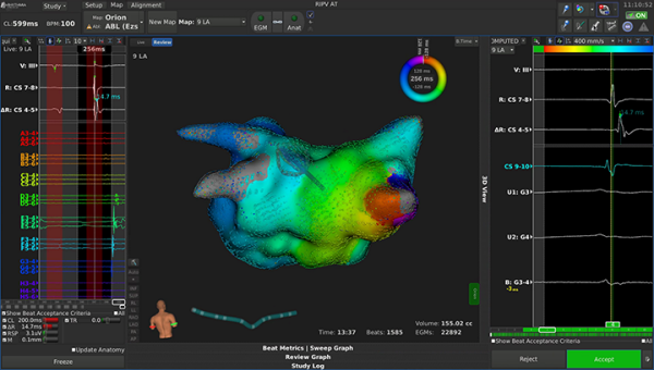 RHYTHMIA HDx™ Mapping System - Boston Scientific
