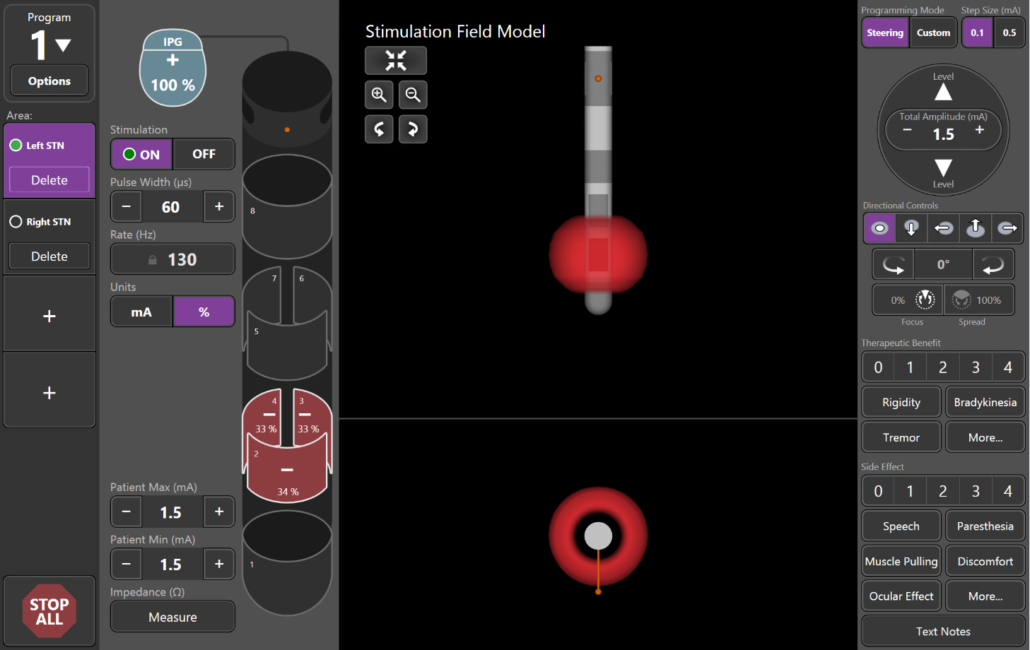 Vercise Directional DBS System - Boston Scientific