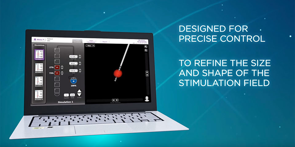 Vercise™ DBS - Boston Scientific