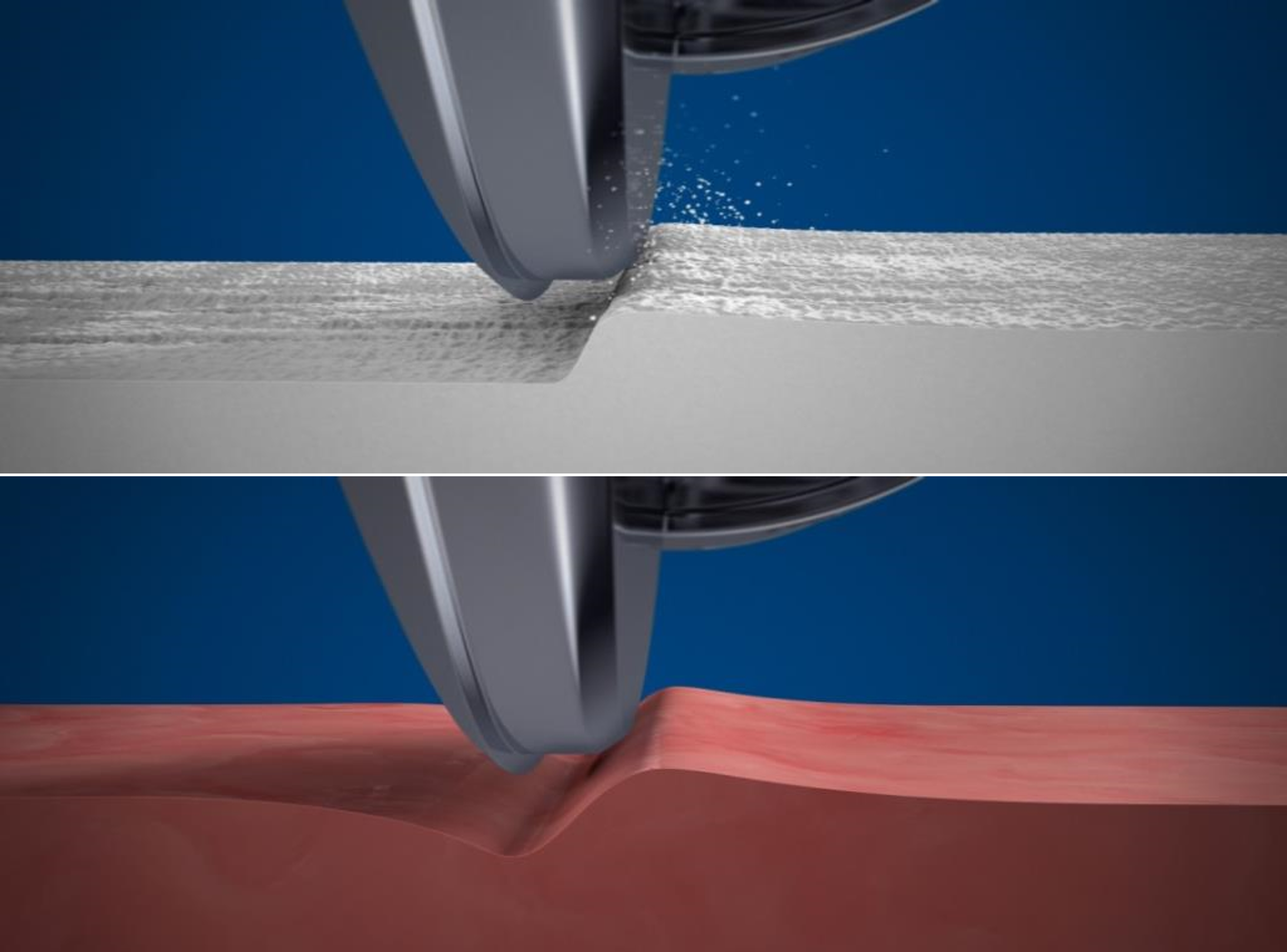 Jetstream™ Atherectomy System - Boston Scientific