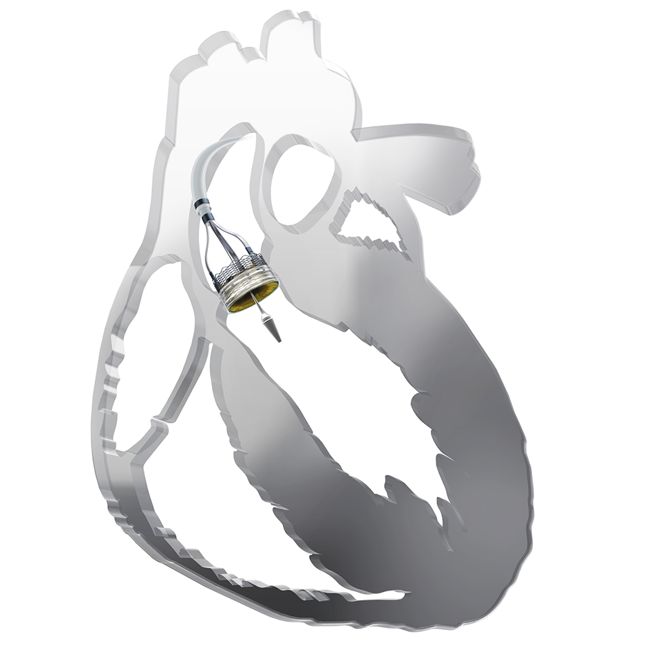 Transcatheter Aortic Valve Implantation (TAVI) with the Lotus Valve ...