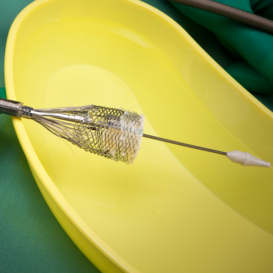 Transcatheter Aortic Valve Implantation (TAVI) with the Lotus Valve ...