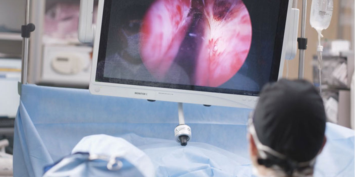 GreenLight after UroLift: insights from physicians - Boston Scientific