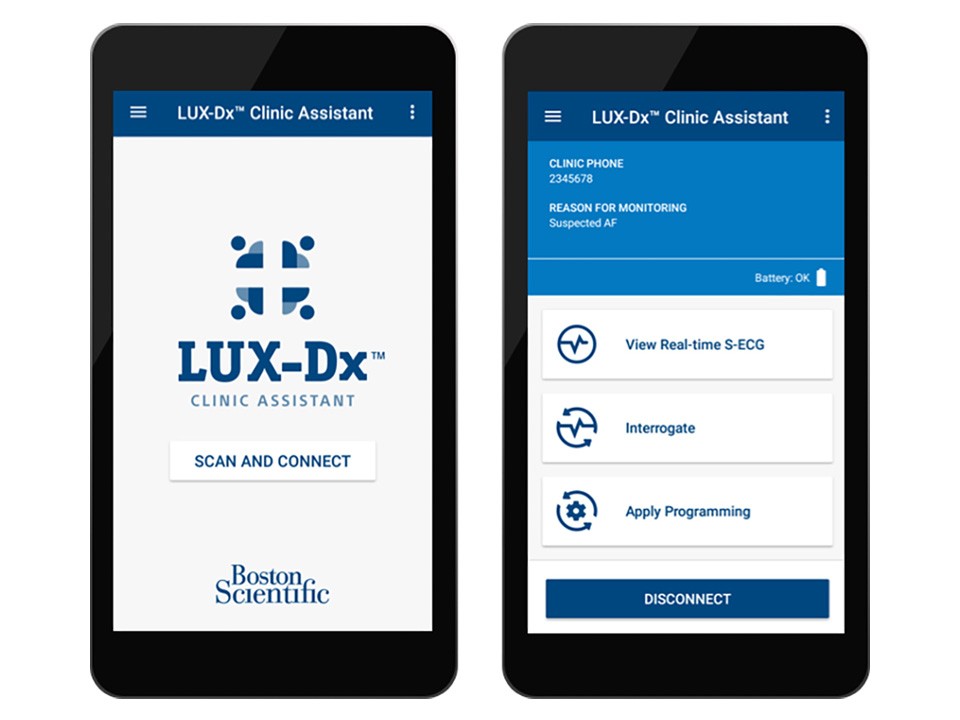 LUX-Dx™ Insertable Cardiac Monitor (ICM) System