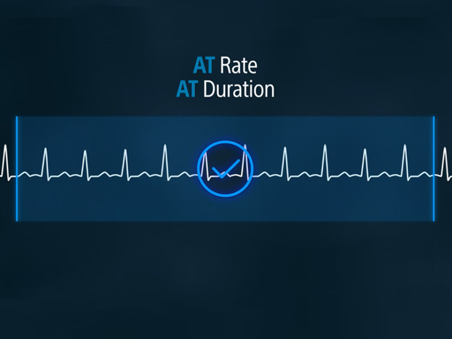 LUX-Dx II™ Insertable Cardiac Monitor (ICM)