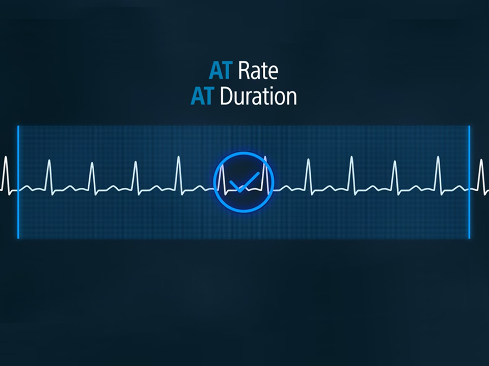 LUX-Dx II™ Insertable Cardiac Monitor (ICM)