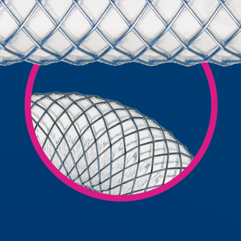 WallFlex Biliary PLUS RX Stent System – Boston Scientific