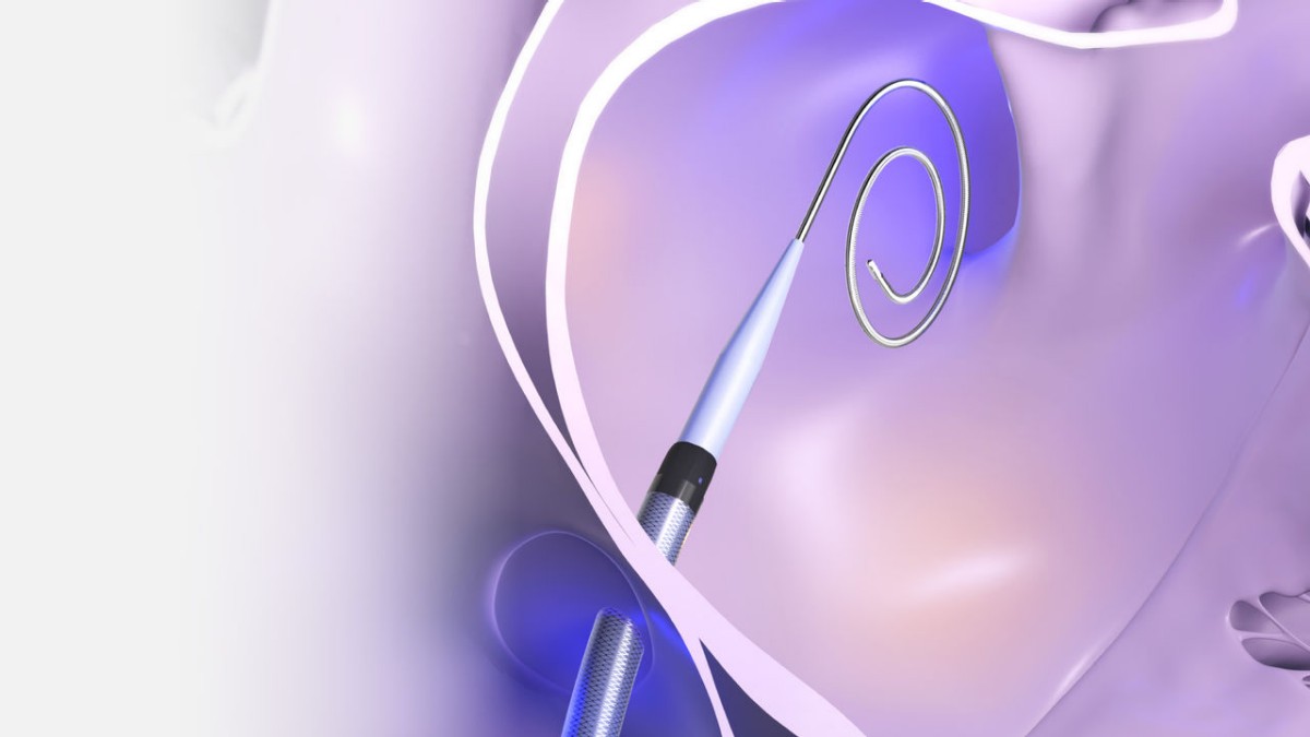 VersaCross Connect™ Access Solution for FARADRIVE™ - Boston Scientific