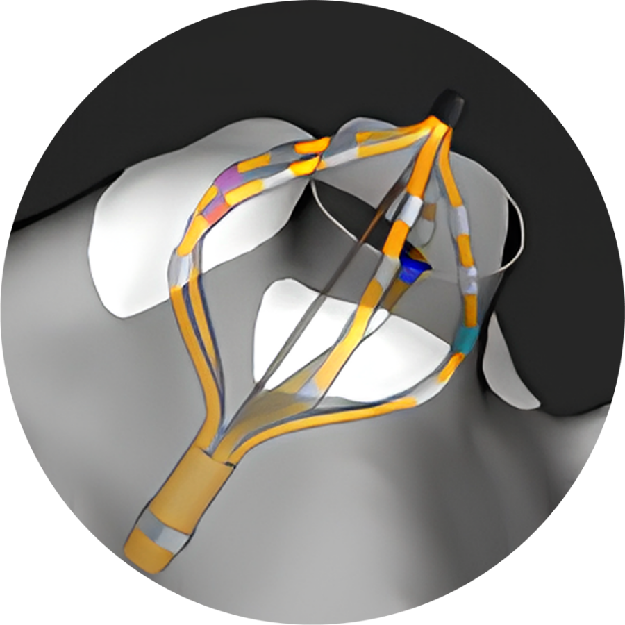 FARAVIEW™ Software Module - FARAPULSE™ PFA Platform