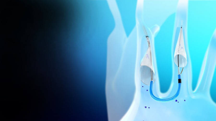 SENTINEL™ Cerebral Protection System