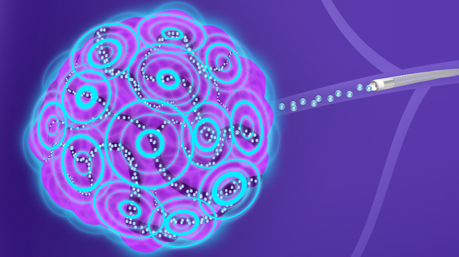 TheraSphere™ Y-90 Glass Microspheres - Boston Scientific