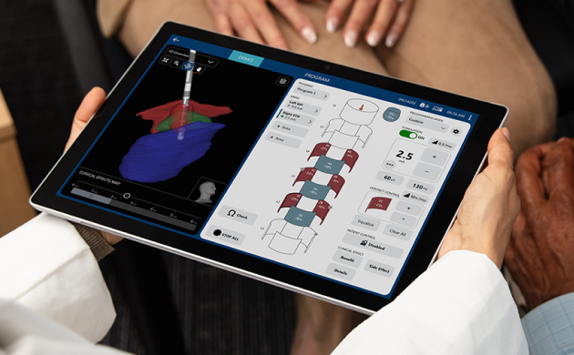 Vercise™ Cartesia™ X and Vercise™ Cartesia™ HX Directional Leads ...