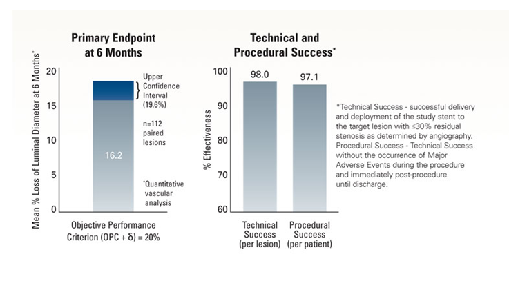 Express™ LD Iliac and Biliary Premounted Stent System - Boston Scientific