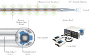 EKOS™ Endovascular System