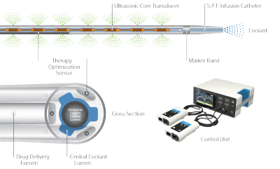 EKOS™ Endovascular System