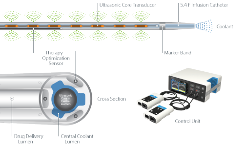 EKOS™ Endovascular System