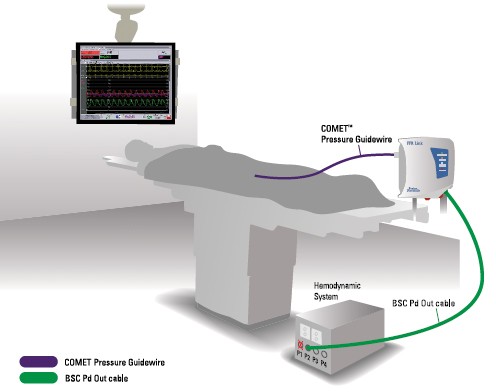 Fast - Boston Scientific