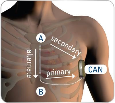 Sophisticated Technology - Boston Scientific