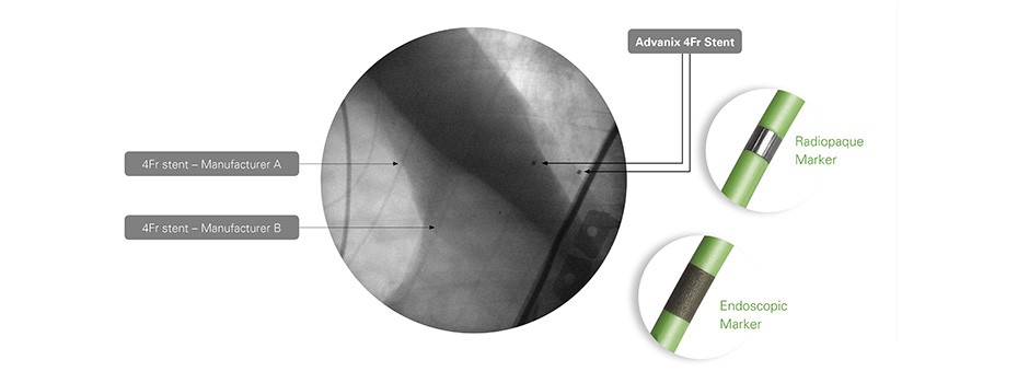 Advanix™ Pancreatic Stent - Boston Scientific