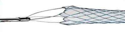 WallFlex Biliary Transhepatic Stent System - Boston Scientific
