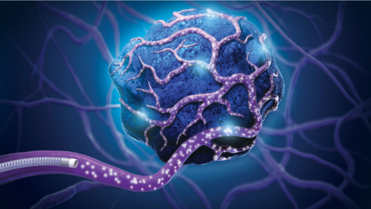 Advancing Science for Life - EU - Boston Scientific - Boston Scientific