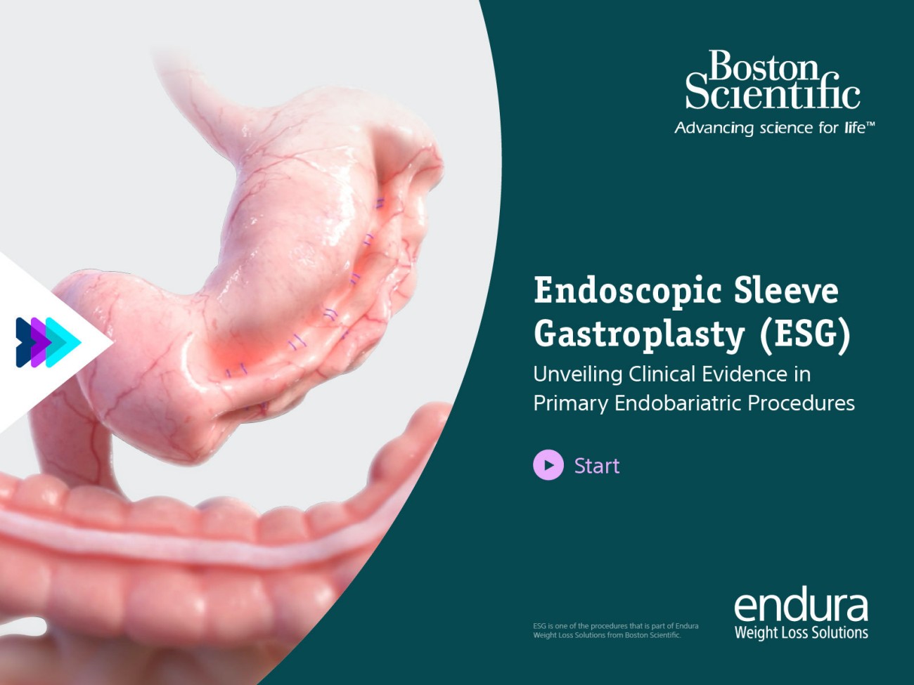 Bariatric Endoscopy - Boston Scientific