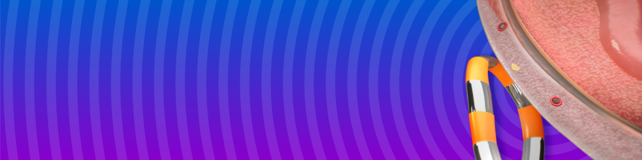 What Is Pulsed Field Ablation Boston Scientific