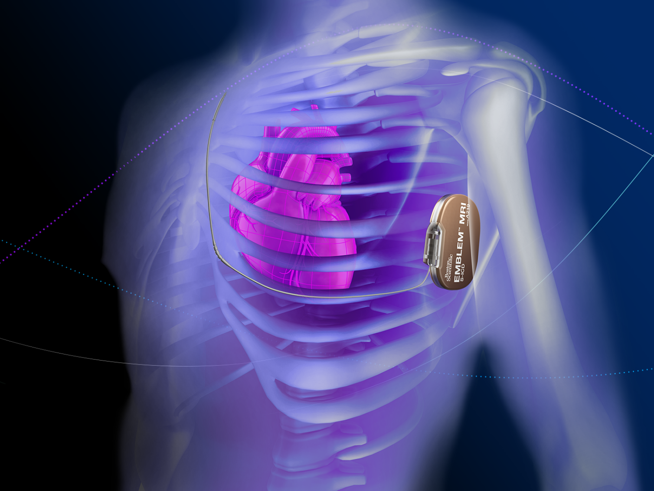 EMBLEM™ mCRM™ System: Future-Ready Cardiac Care with Built-In ...