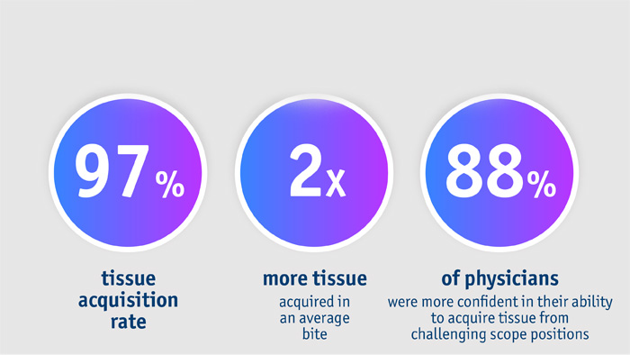 Biopsy Forceps - Boston Scientific