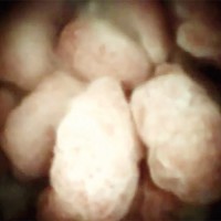 Direct Visualization - Boston Scientific