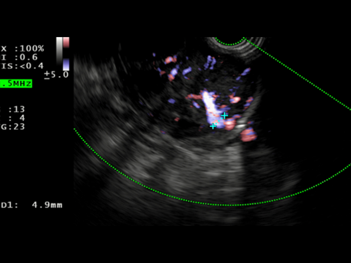Diagnosis Case - Boston Scientific