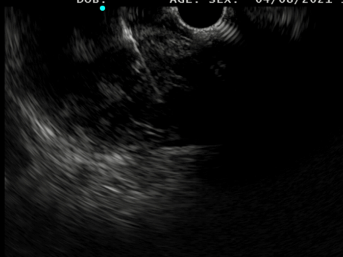 Diagnosis Case - Boston Scientific