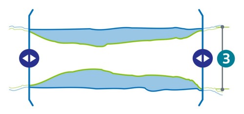 How to IVUS - Boston Scientific
