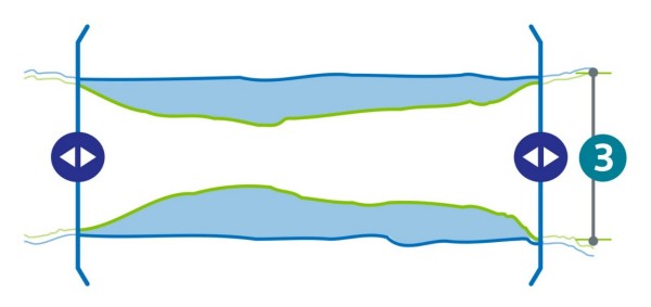 How to IVUS - Boston Scientific