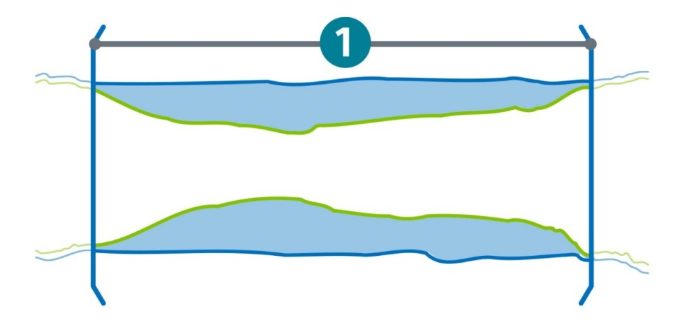 How to IVUS - Boston Scientific
